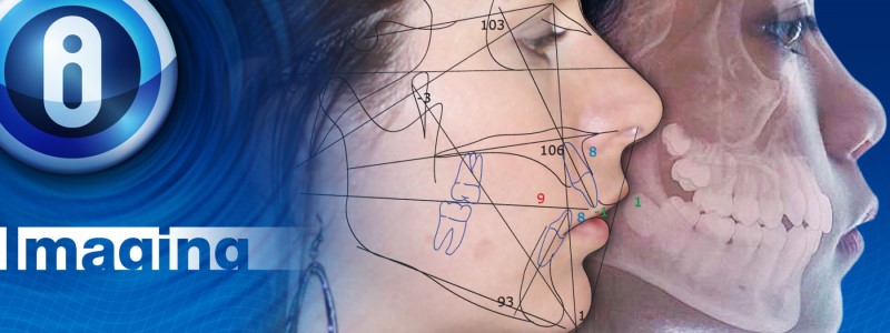 Digident Image Technology Co., Ltd