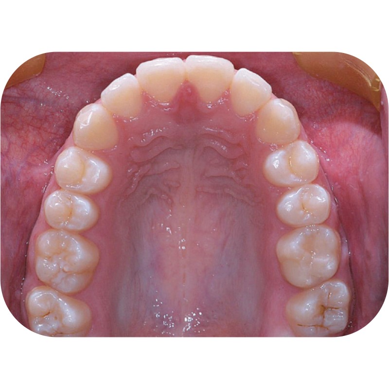 BP-49 LED RING LIGHT | Product | Digident Image Technology Co., Ltd